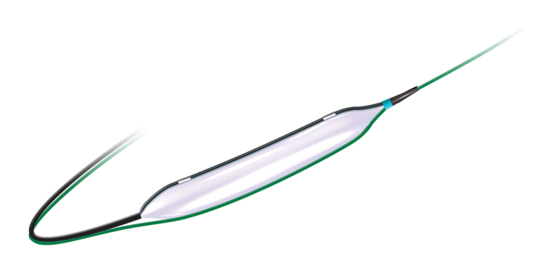 Scoreflex - OrbusNeich