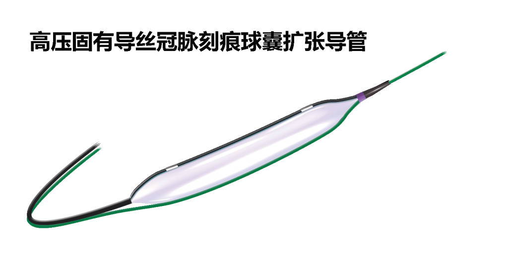 Scoreflex NC - OrbusNeich