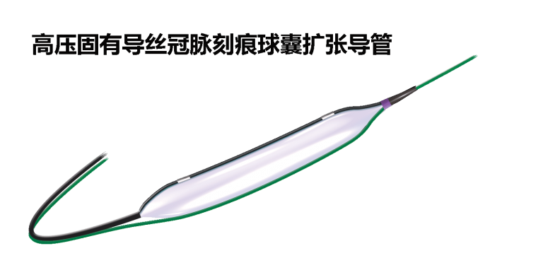 Scoreflex NC - OrbusNeich