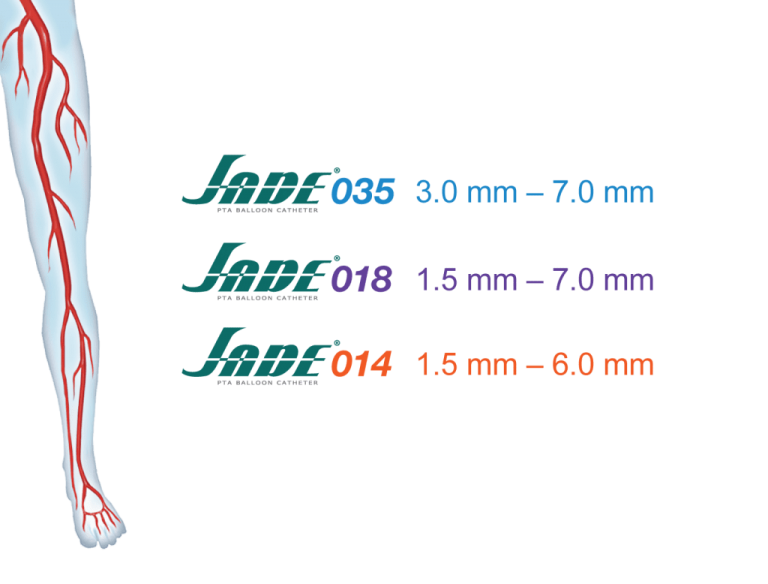 JADE OTW系列 - OrbusNeich