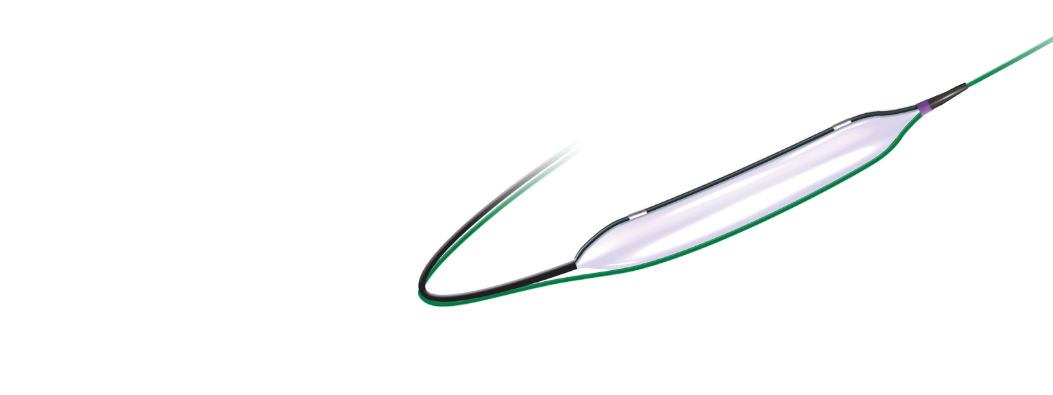 Scoreflex NC - OrbusNeich