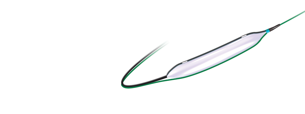 Scoreflex - OrbusNeich